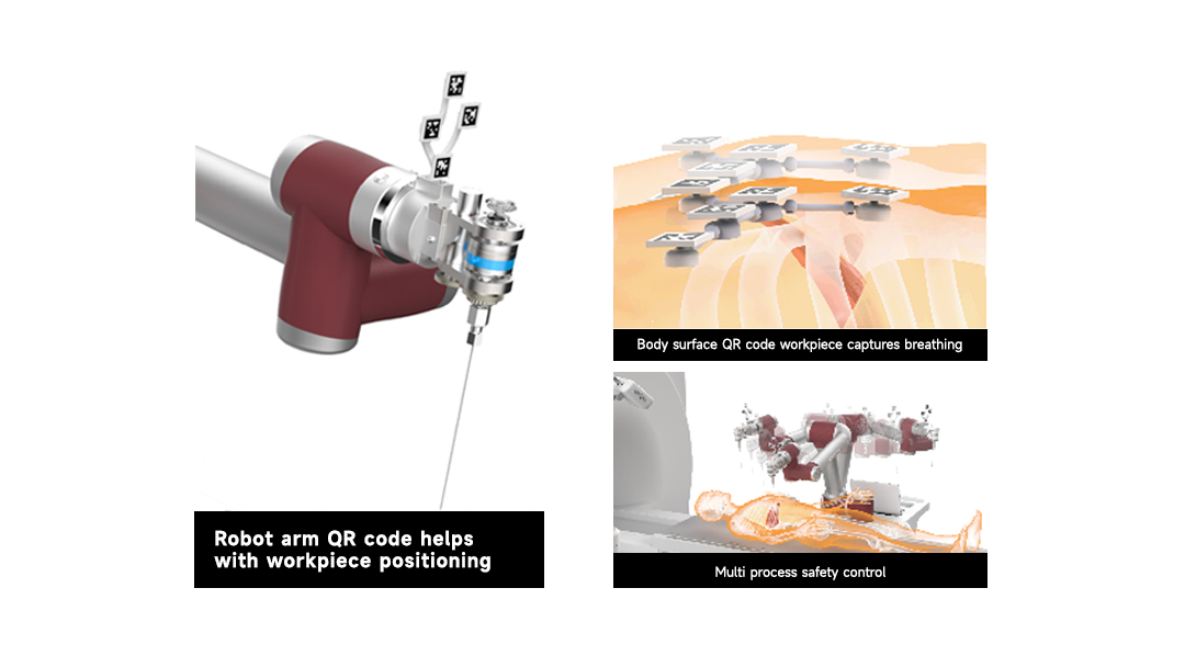 SGNIP - Percutaneous intervention - Products - HANGLOK-TECH